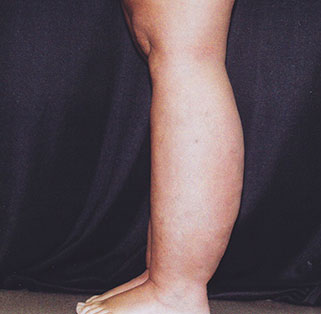 Guys, do you find thick legs attractive? - GirlsAskGuys